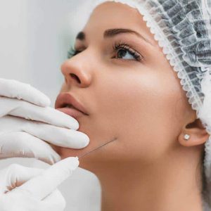 Best Thread Lift Treatment in Kolkata using Dermal Threads with Latest ...