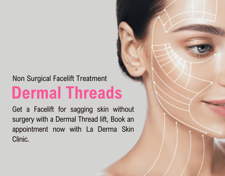 Best Thread Lift Treatment in Kolkata using Dermal Threads with Latest ...