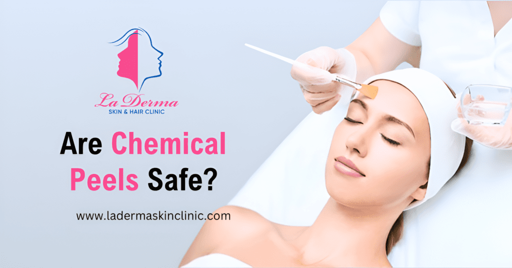Are Chemical Peels Safe? | La Derma Skin Clinic, Kolkata