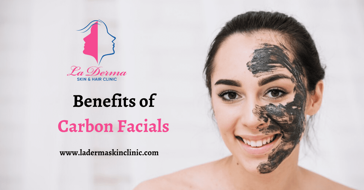 What are the Skin Benefits of Carbon Facials? | La Derma Skin Clinic